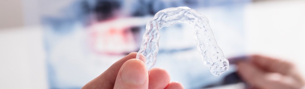 iTero for Invisalign in Edison, NJ | iTero Scanner Edison NJ